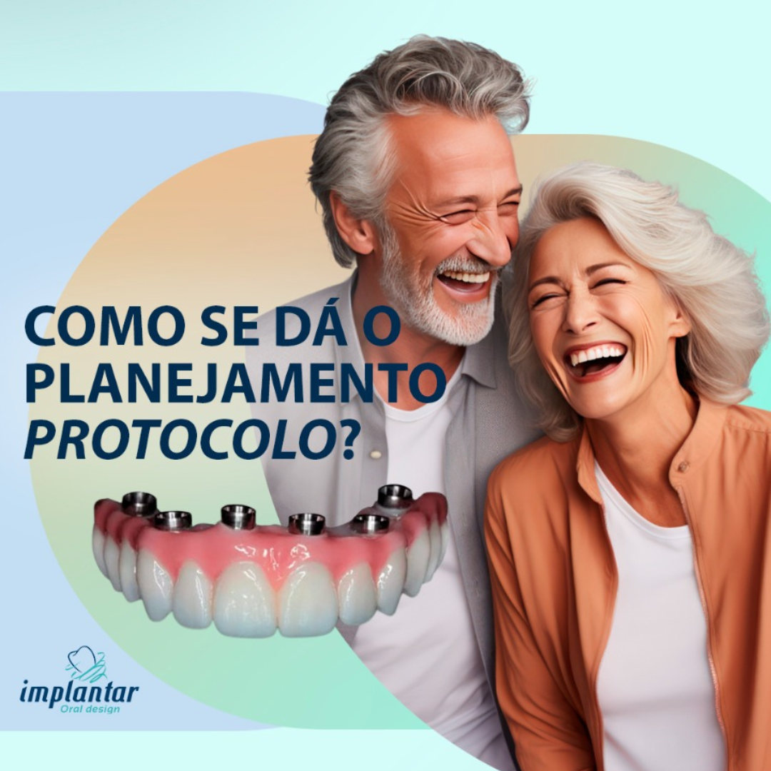 O que é a Moldagem de Transferência do implante na Prótese tipo ...